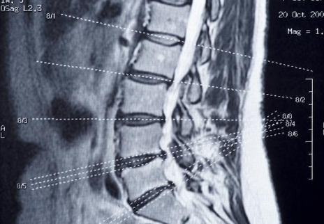 Bone Health BC: ﻿Mobile Bone Density Scanning at Integrative…