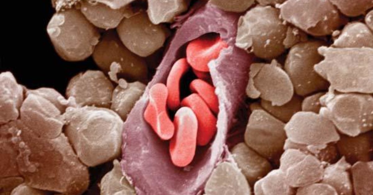 Harnessing the Power of UV Light: Exploring Ultraviolet Blood…